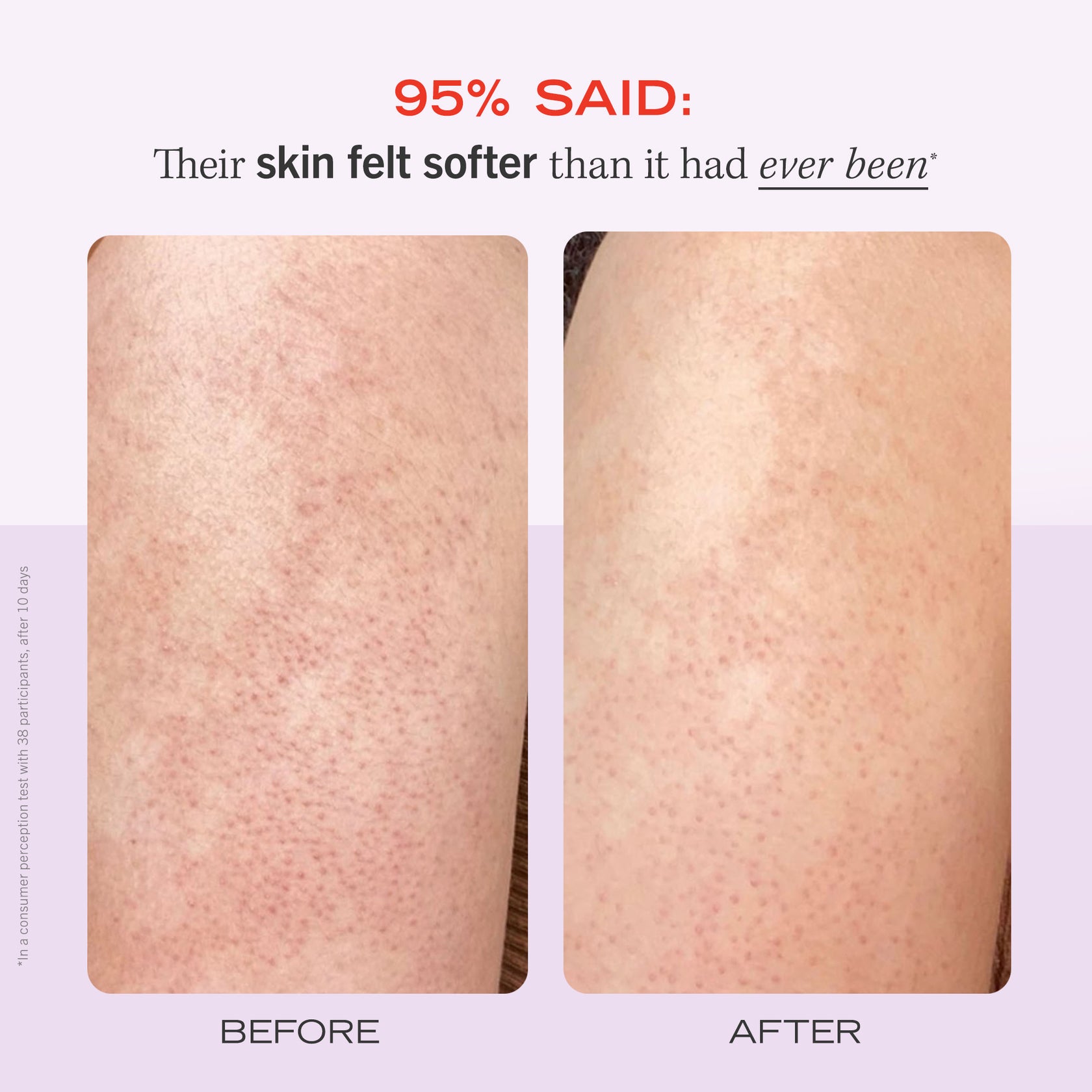 KP Bump Eraser Body Scrub 10% AHA Fresh Strawberry – First Aid Beauty