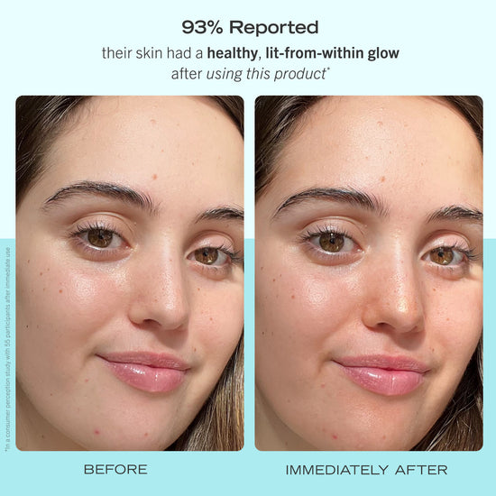 Bronze + Glow Drops with Niacinamide – First Aid Beauty