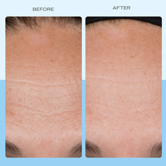 Firming Cream with Peptides, Niacinamide + Collagen – First Aid Beauty